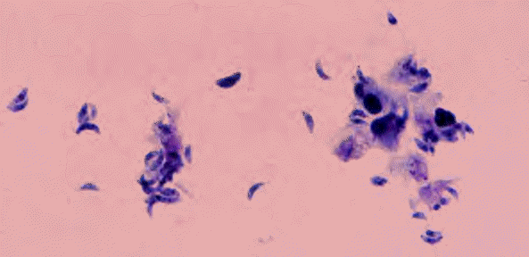 Toxoplasmosis Microscopic Features